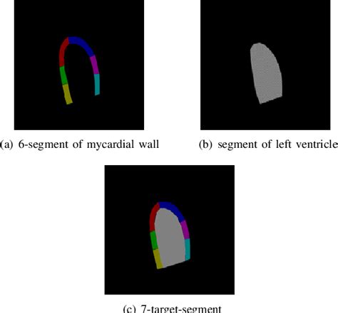Figure From Study On Echocardiographic Image Segmentation Based On Attention U Net Semantic