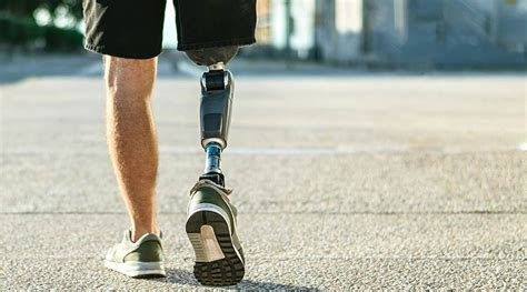 Amputee Rehabilitation Reha Nach Amputation Sgeiz
