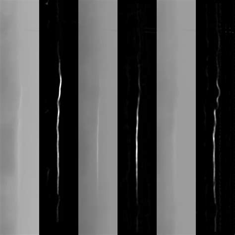 Structure Oriented Filtering Of Image Of Crack In Ring Welding For