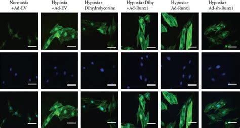 Ae Dihydrolycorine Mitigated Adverse Cardiac Remodeling After