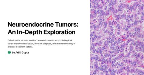 Neuroendocrine Tumors An In Depth Exploration