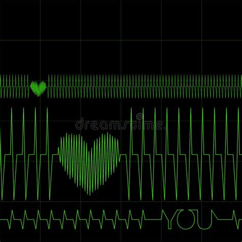 Heart Monitor Stock Illustration Illustration Of Electronic 2976093
