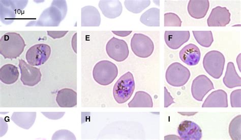 Plasmodium Knowlesi Scientists Against Malaria