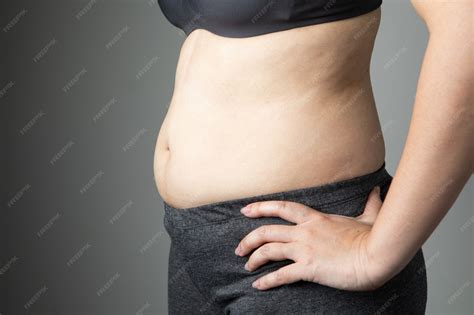 Premium Photo Fat Woman Cellulite Belly Unhealthy