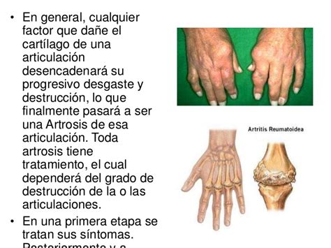 BIOLOGY JR ÁLBUM DE IMAGENES DE ALGUNAS ENFERMEDADES DEL SISTEMA