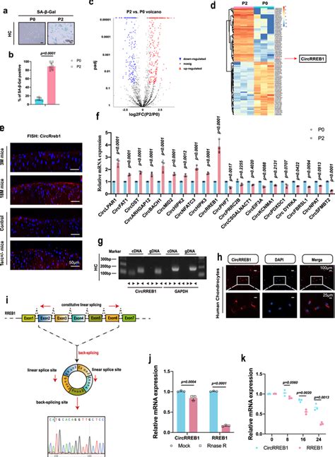 CircRREB1 Mediates Lipid Metabolism Related Senescent Phenotypes In