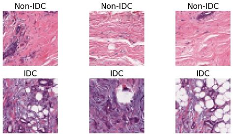 Comparative Analysis Of Transfer Learning Models For Breast Cancer Classification Ai Research