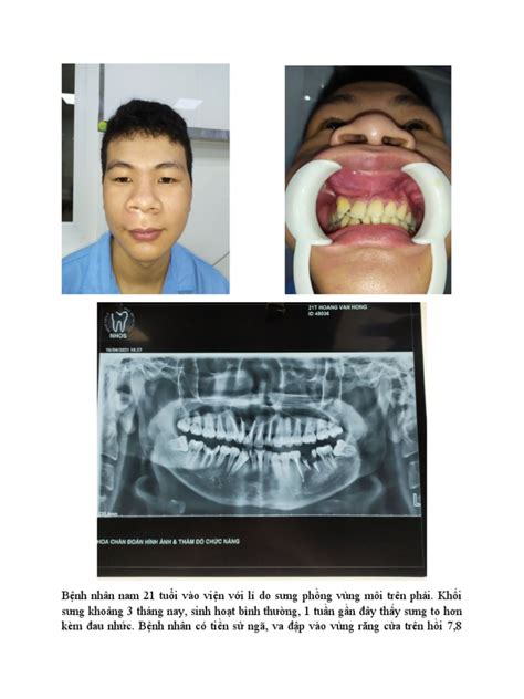 Case 4 Pdf