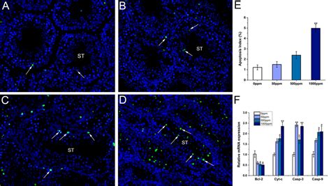 Effect Of Pb Exposure On Testicular Cells Apoptosis Detected By Tunel