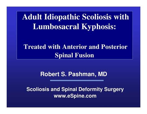 Case Review 4 31 Year Old Woman With Adult Idiopathic Scoliosis