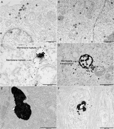 5 Transmission Electron Microscopy Tem Of Hela Cells Incubated For