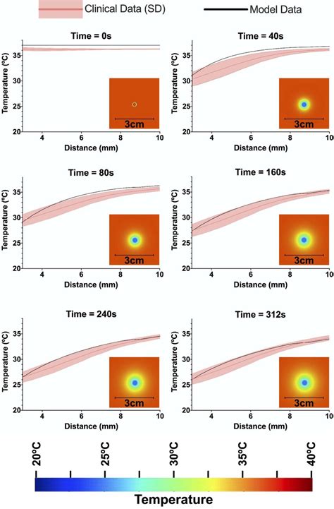 Comparing Radial Model Cooling To Clinical Data The Average Radial