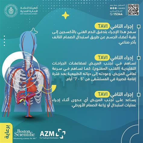 Tavi تقنية طبية عالمية لعلاج ضيق الصمام الأورطى بالقلب إنفوجراف مبتدا