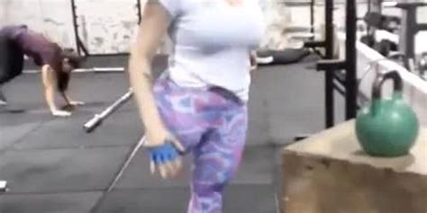 Amputee