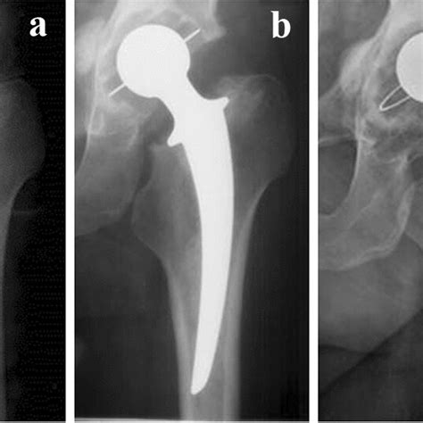 Examples Of A Wear Marks B Scratches And C D Polishing Marks On