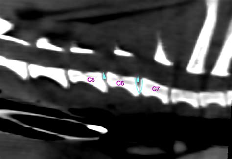Ct Intervertebral Disc Disease Ivdd With Compressive Myelopathy In A 3 Year Old Fs Chihuahua