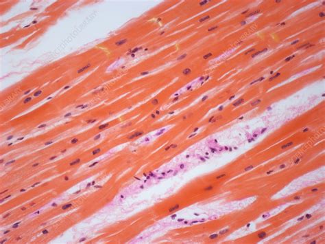 Human Cardiac Muscle Light Micrograph Stock Image C0210475