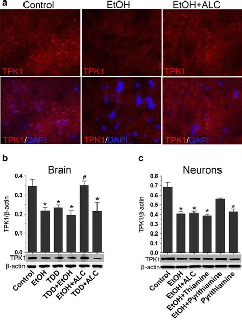 Etoh Downregulates Thiamine Pyrophokinase 1 Levels Tpk1 A Download Scientific Diagram