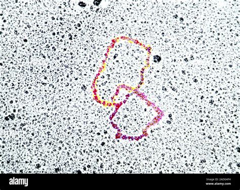 Bacterial Plasmids Coloured Transmission Electron Micrograph Tem Of