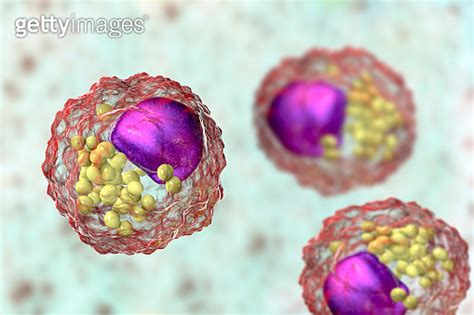 Foam Cell Macrophage Cells That Contain Lipid Droplets 1155203103