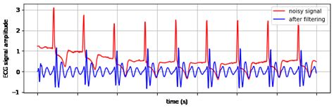 Ecg Signal Before And After The Application Of The Bandpass Filter The