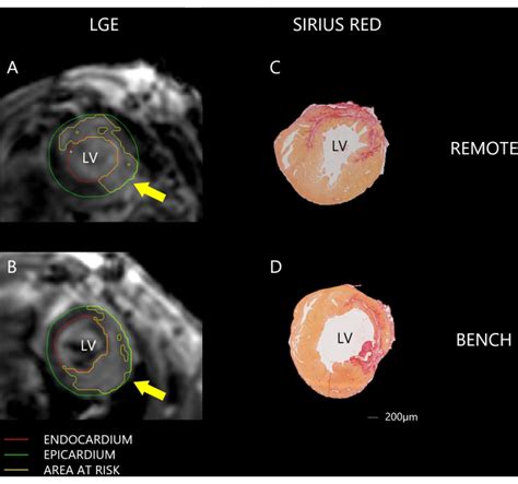 Video Author Spotlight A Novel Standardized Technique For Real Time
