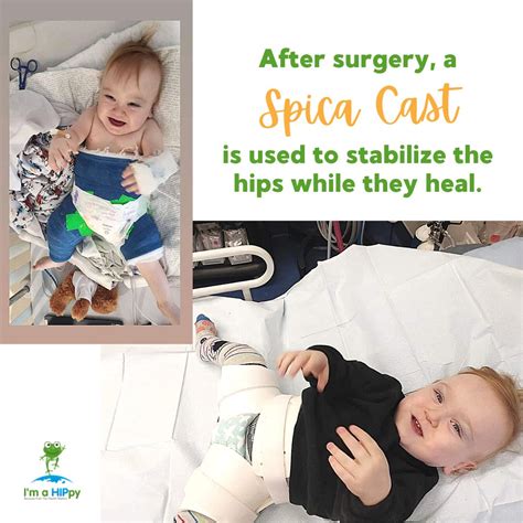 Hip Spica Diaper