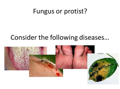 58 Diseases Caused By Fungi And Protists New Gcse Biology