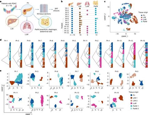 Spatial Mapping Of Transcriptomic Plasticity In Metastatic Pancreatic