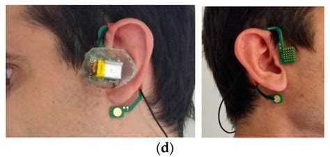 Sensors Special Issue Non Invasive Biomedical Sensors