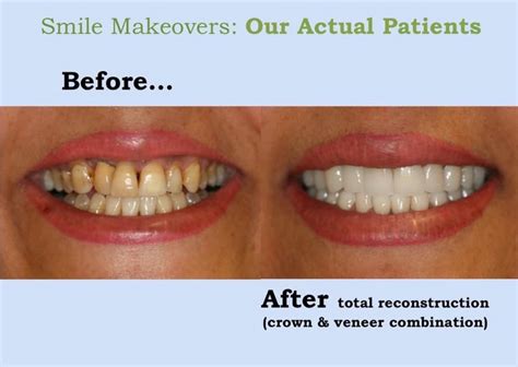 Cosmetic Dentistry In Nyc