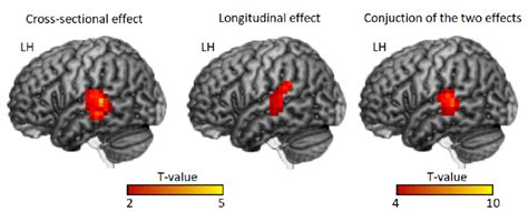 Spatial Localization Of The Audiovisual Congruency Effect For Readers Download Scientific