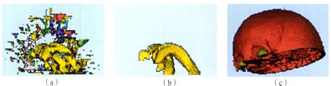 一、基于mri和ct数据集的数字人体交互式3d分割 生物医学 医学