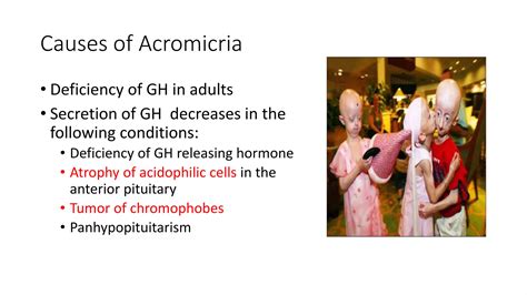 Clinical Feature Of Ant Pituitary Gland Ppt