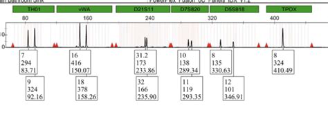 Solved At The ‘tpox Locus Is Allelic Dropout Likely Or Is