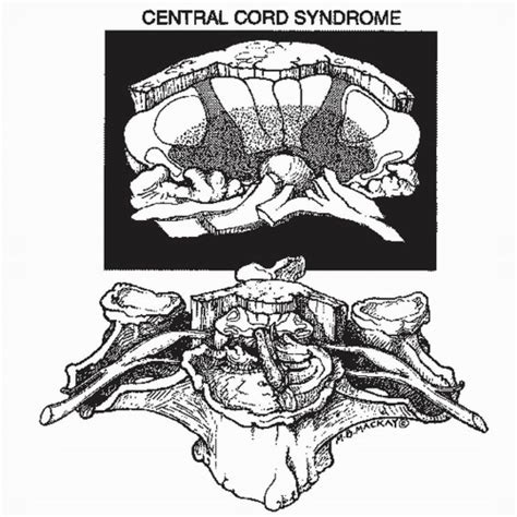 Neurologic Examination Grading Scales Neupsy Key