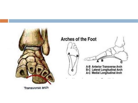 Plantar Keratosis