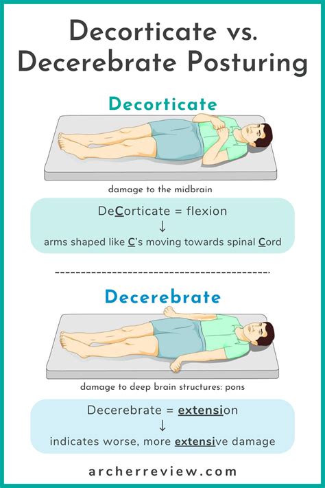 The Two Major Types Of Posturing Tested On The Nclex Are Decorticate