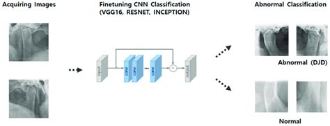 Tmj Oa Classification Model Download Scientific Diagram