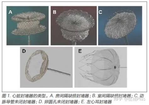 国产厂商引领心脏封堵器变革 知乎