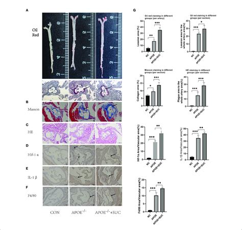 Succinateil 1b Signal Axis In Atherosclerosis Model Stainings A