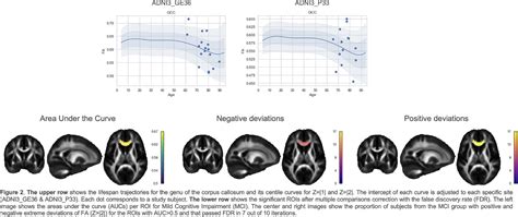 Large‐scale Normative Modeling Of Brain Microstructure Over The Human Lifespan Villalon‐reina