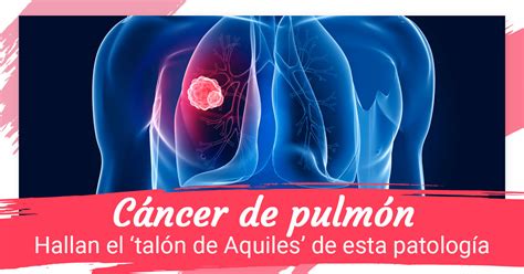 El Cima Universidad De Navarra Descubre El ‘talón De Aquiles Del