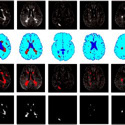 Brain Tissue Segmentation Examples
