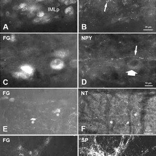 Sympathetic Preganglionic Neurons And Neuropeptide Immunoreactivity In Download Scientific