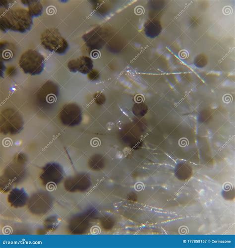 Aspergillus Niger And Aspergillus Oryzae Mold Under Microscope Stock