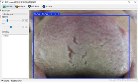 基于yolov8的舌苔识别检测系统python源码onnx模型评估指标曲线精美gui界面舌苔yolo Csdn博客