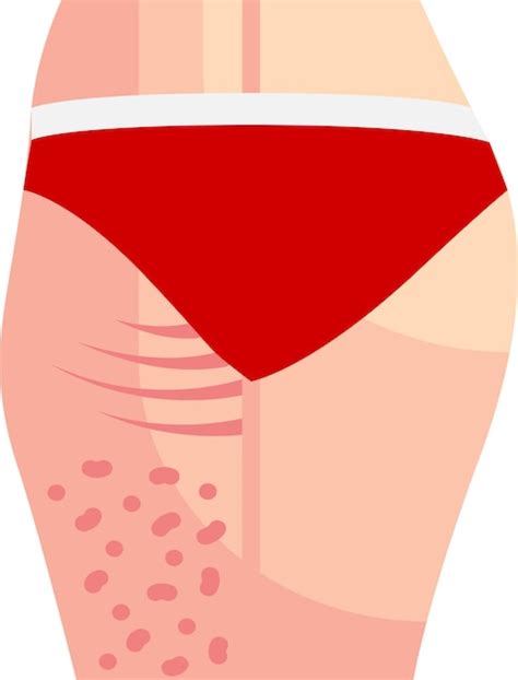 Premium Vector Thigh Lift Or Thighplasty Exfoliation Vector Design