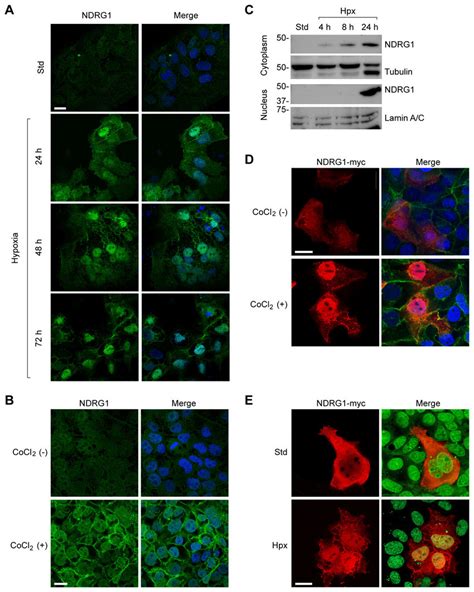 The Sub Cellular Localization Of Ndrg1 In Response To Hypoxic Injury