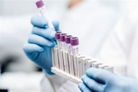 High Complexity Medical Laboratory Lab Testing Matters